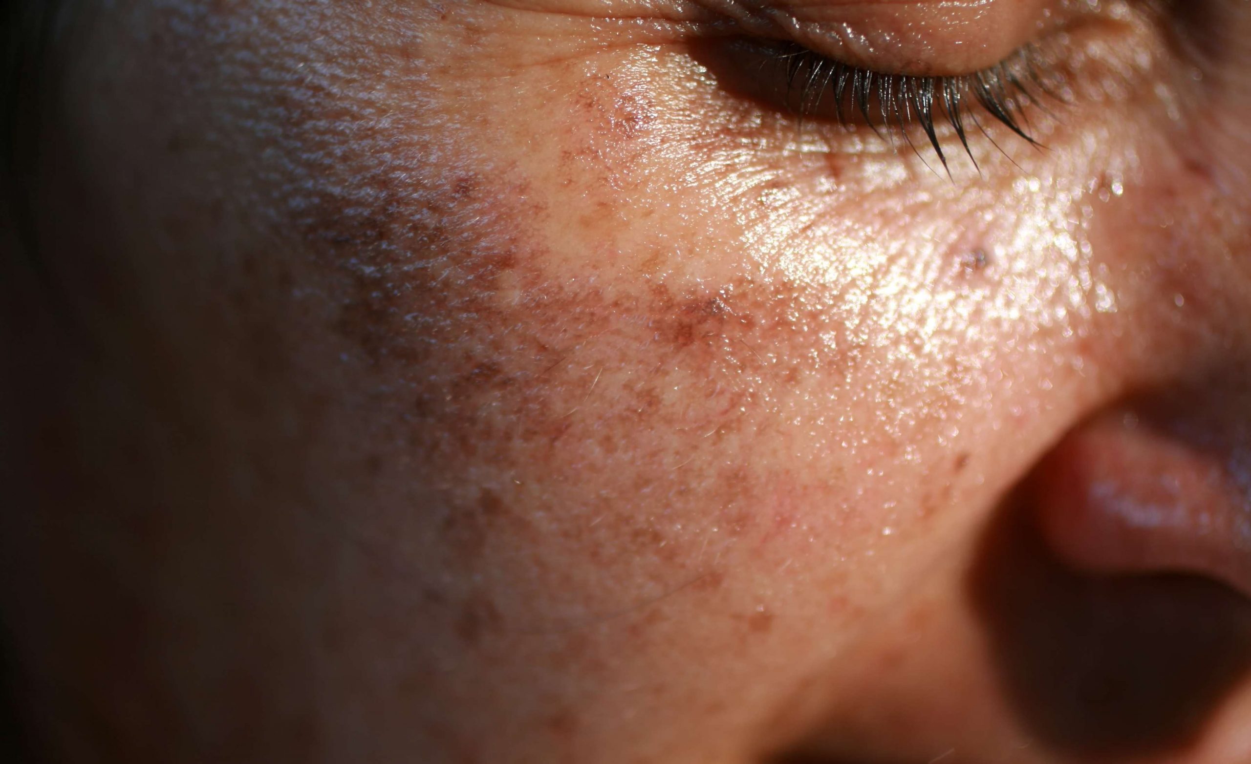 Ten Things You Can Do This Summer to Reduce Sun Damage - Mommy B Knows Best