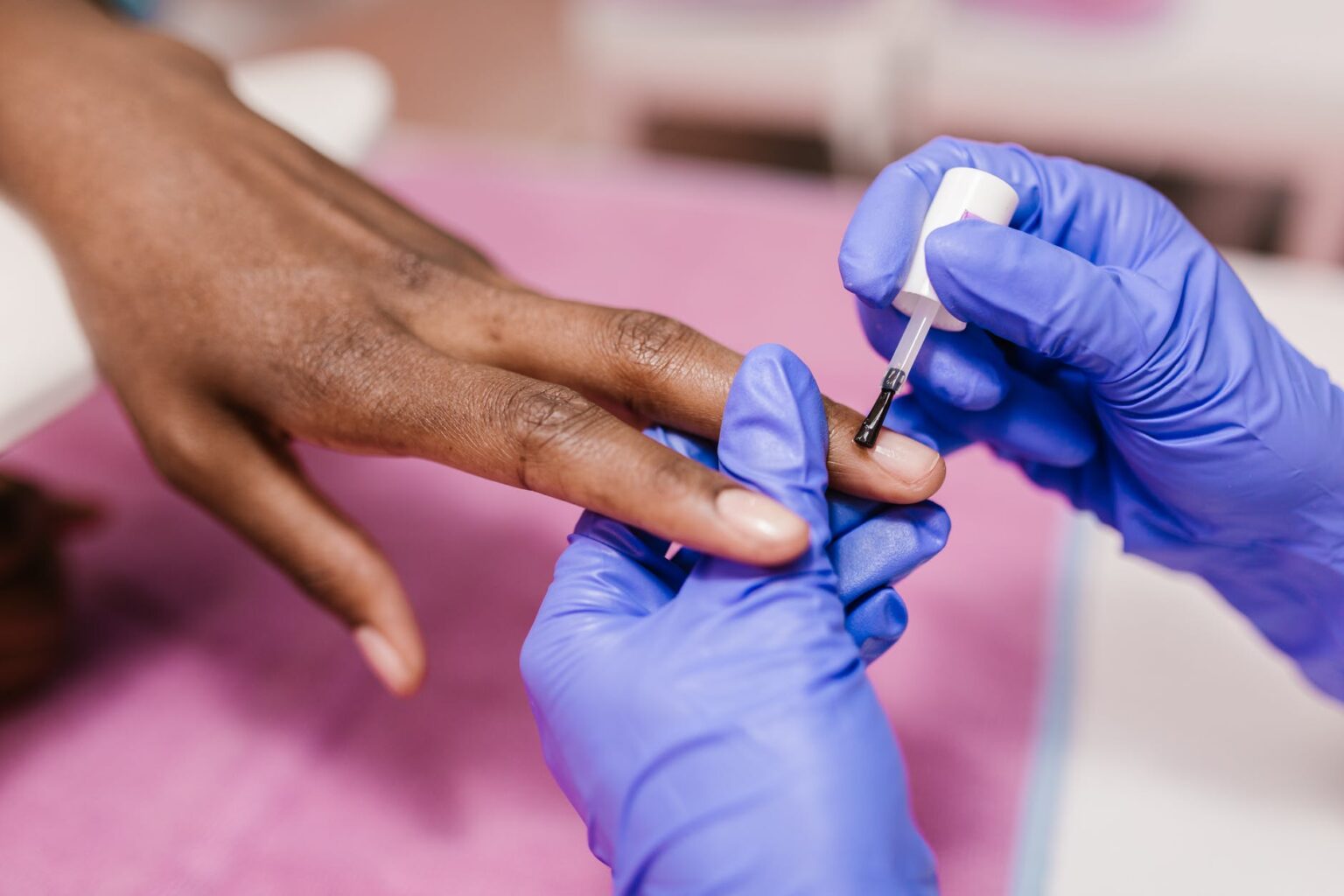 How Dehydration Impacts Your Nails - 2024 Guide - Mommy B Knows Best